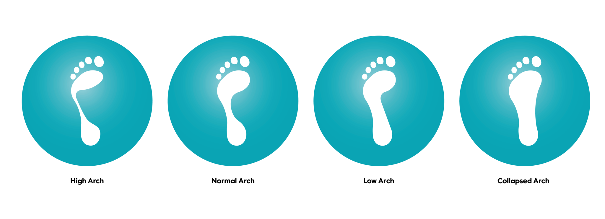 What Are High Arches? Causes, Symptoms & Ultimate Treatment